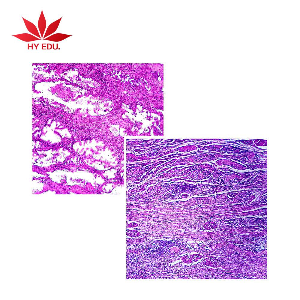 Professional 31pieces Human Oral histological general pathology ...
